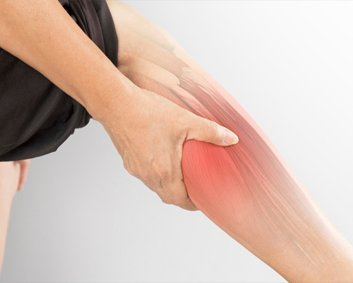 Myalgia: Muscle Pain - Pharmacy Dragon